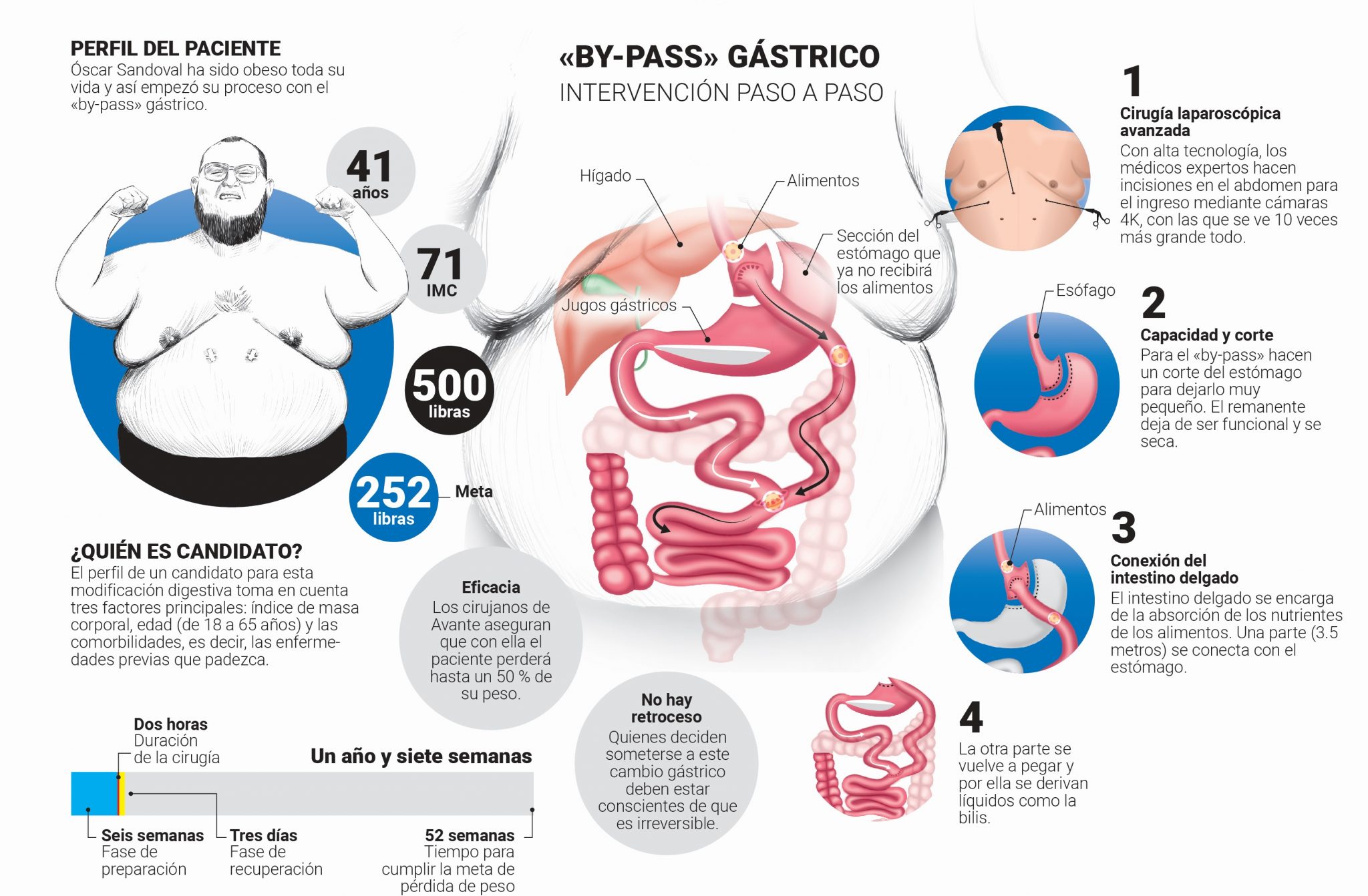 Bypas-GRAF1 – Diario El Salvador