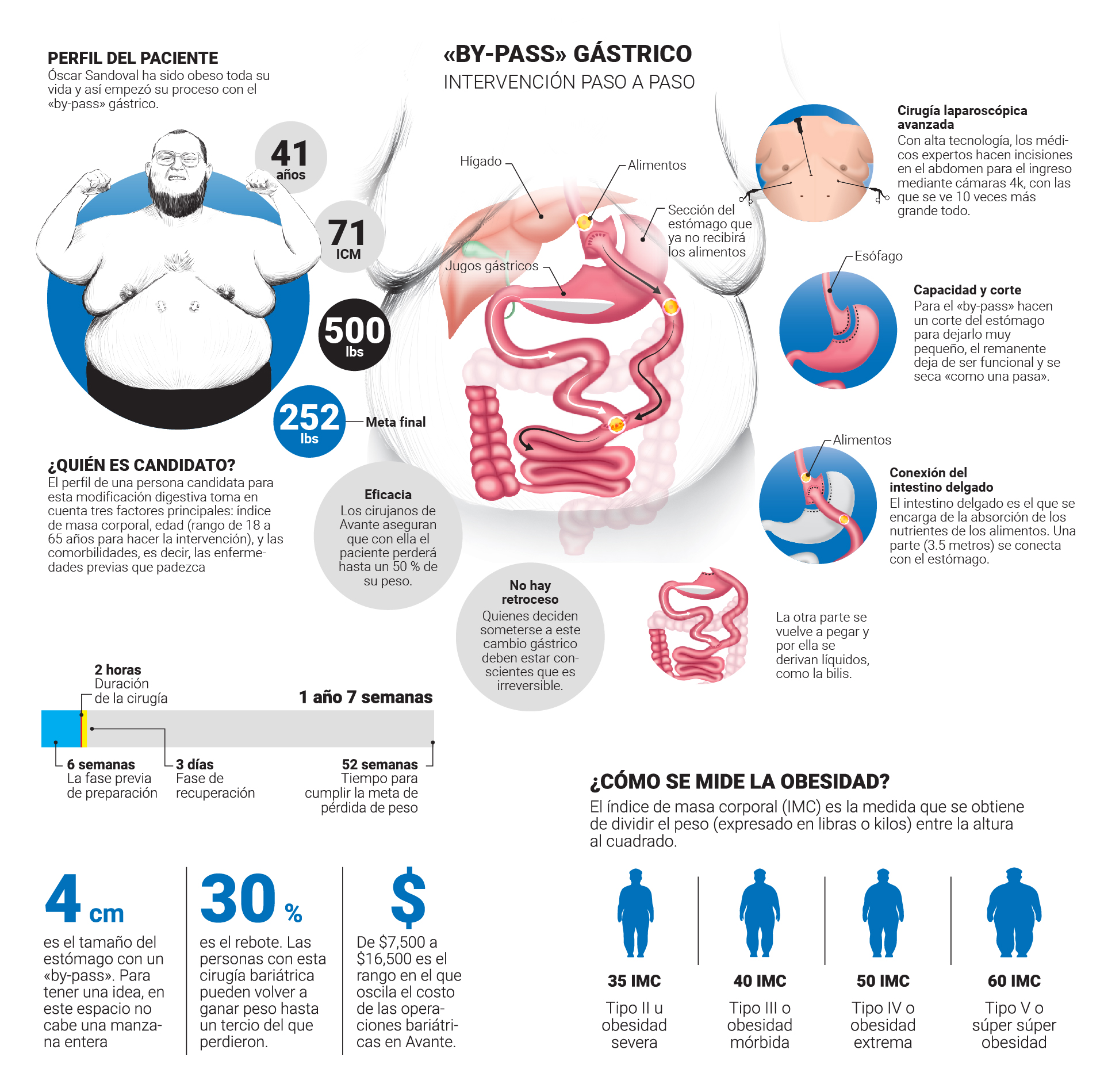 by-pass-info – Diario El Salvador