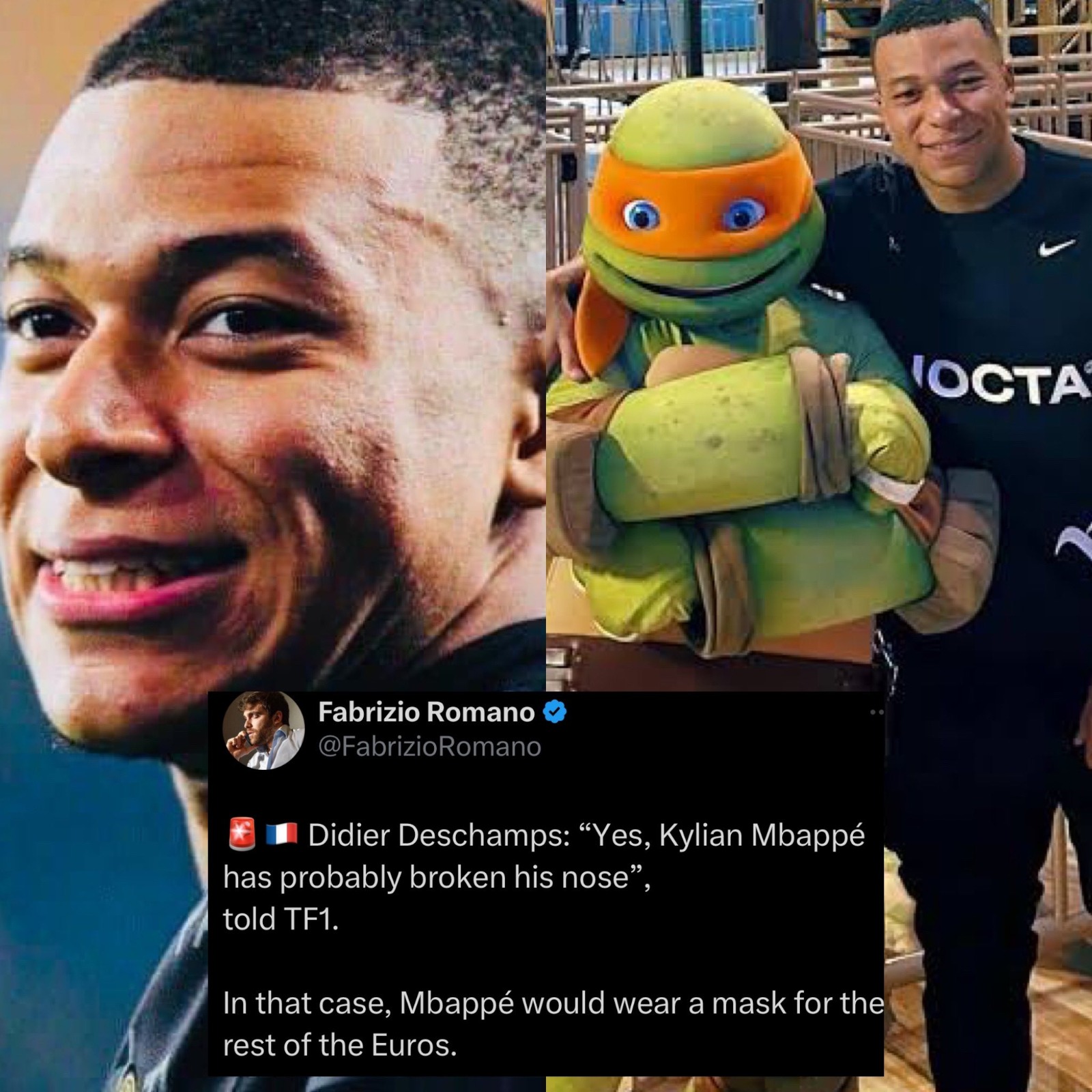 Fotos: Abundantes memes por la fractura de Mbappé y el pésimo partido ...